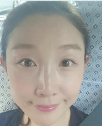 小原正子の顔が変わった？昔は一重？整形が噂される理由4つとは？｜お笑い芸能HEADLINE